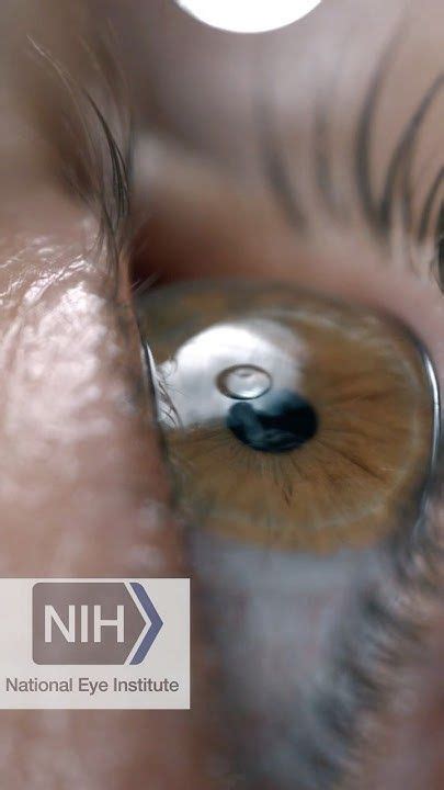 Nei Scientists Develop Eye Drops For Rp And Amd National Eye