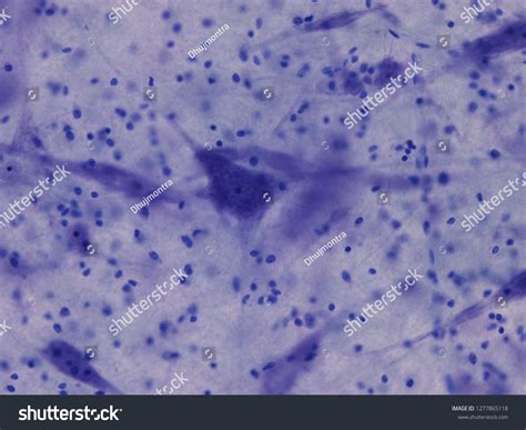 Multipolar Neuron Under Microscope