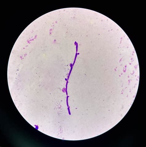Bread Yeast Under Microscope