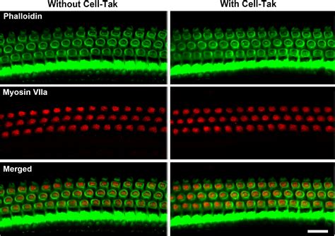 Cochlear Surface Preparation In The Adult Mouse