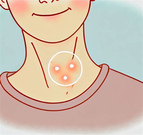 임파선염 증상 치료 원인 통증 네이버 블로그