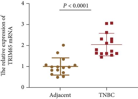 Trim65 Is Upregulated In Tnbc A B Analysis Of Ihc And Download