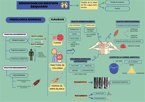 Síndrome De Brown SÉquard Causas Y Tratamientos Efectivos