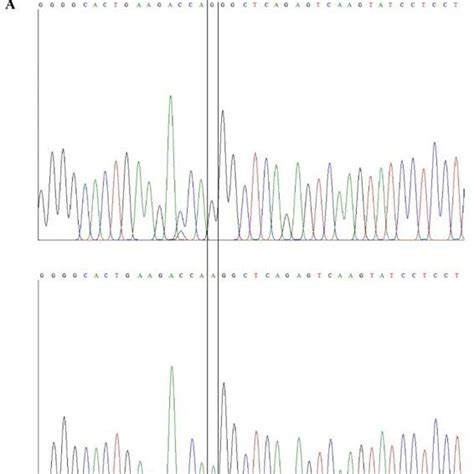 Single Nucleotide Polymorphism Snp Variant Of Kiss 1 Gene In Nigerian