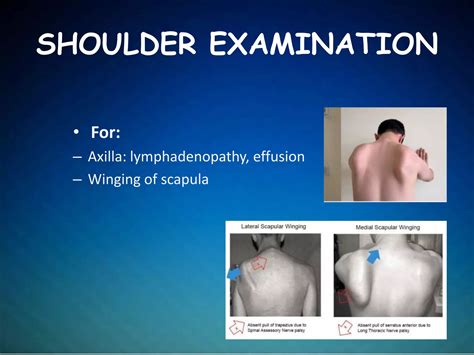Clinical Shoulder Examination Osce Pptx