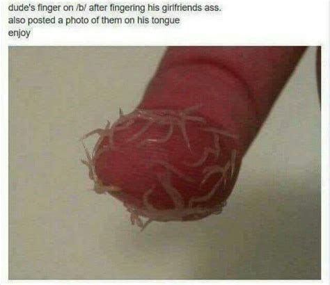 Pin Worms In Humans Anus