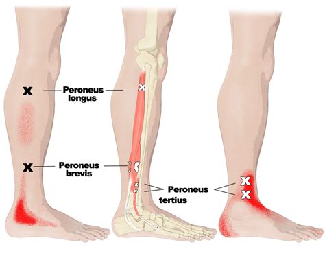 Fibularis Longus Muscle Peroneus Longus Muscle Yoganatomy