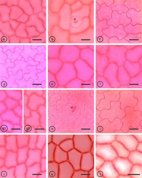 Passiflora Spp View Of The Leaf Surface Epidermis Adaxial Side