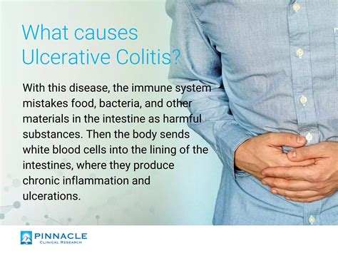 Understanding Ulcerative Colitis Ppt