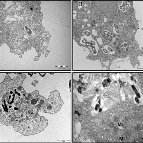 Transmission Electron Microscopic Observation Of M Mucogenicum 2 H