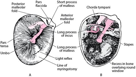 Imagetympanic Membrane Of Right Ear A Tympanic Cavity With Tympanic
