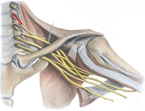 Anatomy Of Nerve Plexuses Brachial Plexus Branches C5 T1 Flashcards
