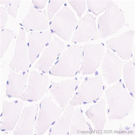 Nectin 4抗体[epr21192 113] Bsa And Azide Free Detector Ab270316 Abcam中文官网