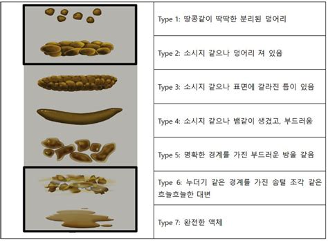 Medigate News 만성 변비 그것이 알고 싶다