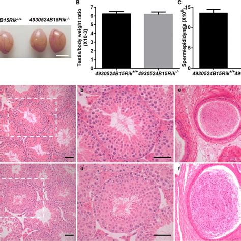 Progression Of Meiotic Prophase I A Surface Spread Spermatocyte Download Scientific Diagram