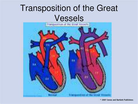 Ppt Understanding The Anatomy And Function Of The Heart In The