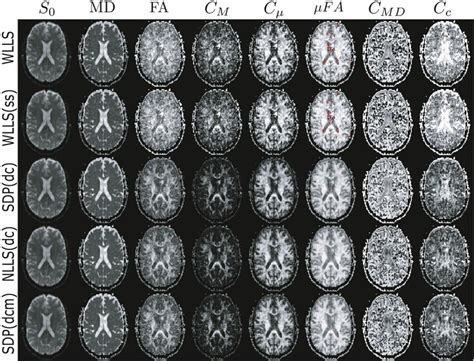Maps Estimated Through Various Methods From Data Involving 56 Volumes Download Scientific