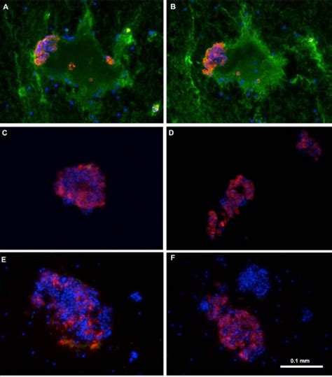 Binding Of Human Igm And Igg Antibody To Pig Islets Xenogeneic Ab