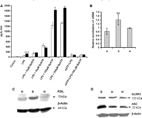 Figure 1 From Dysregulation Of P2x7 Receptor Inflammasome Axis In Sapho