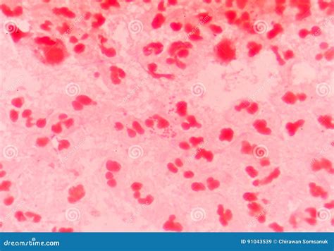 Gram Negative Bacillus Gram Stain Stock Image 178095601