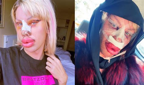 Honza Šimša Promluvil O Plastice V Íránu Usekli A Zbrousili Mi Bradu