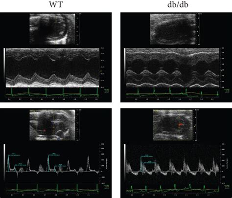 Cardiac Dysfunction Camkiiδ Activity And Ripk3 Expression Are