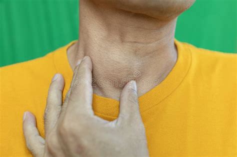 Thyroid Gland Inflammation At Neck Goiter Throat Cancer Sore Throat
