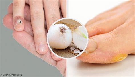 Naturally Remove Calluses From Hands And Feet Step To Health Naturally Remove Calluses From Hands And Feet Step To Health