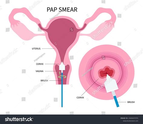 Pap Smear Photos Images And Pictures Shutterstock