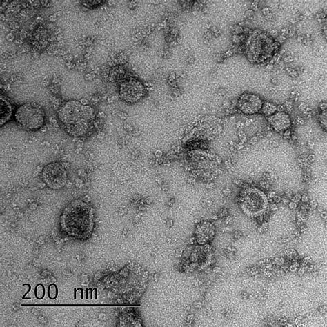 Vesicles Micrograph