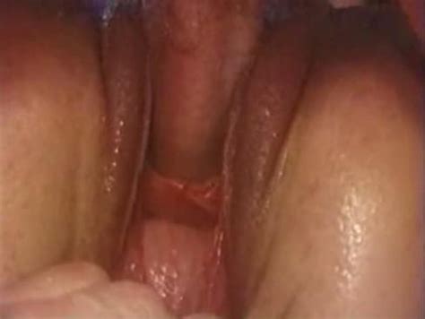 Female Pee Hole Sounding