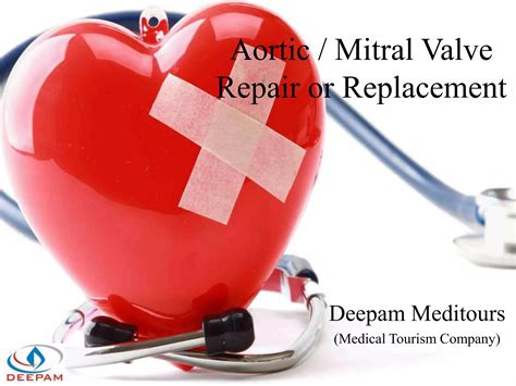 Avr Mvr All You Need To Know About Valve Repair And Replacement Pptx