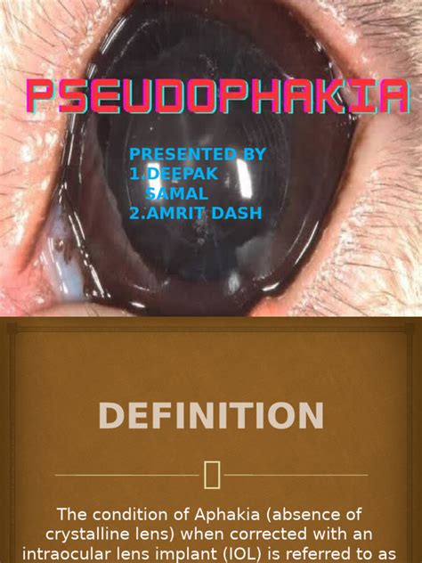 Pseudophakia Pdf