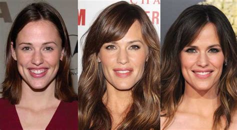 Jennifer Garner Plastic Surgery Before And After Pictures 2025