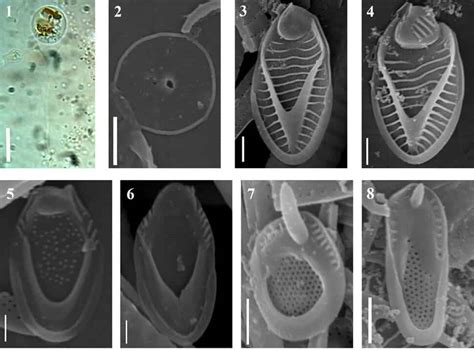 Sphagnum Associated Chrysophytes From The “dermansko Ostrozsky
