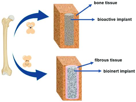 Body Response To A Bioactive And Bioinert Material Download