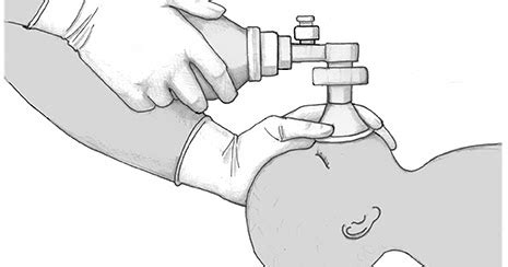 Obgyn Updated Acog Updates Its Guidelines On Management Of Newborn