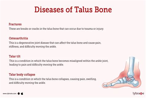 Talus Bone Human Anatomy Image Functions Diseases And Treatments