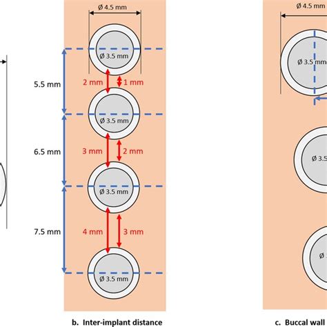 Schematic Representation Of A Implant Shoulder And Maximum Outer Thread