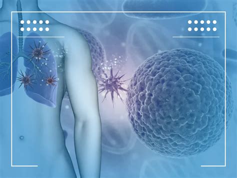 Lung Cancer Metastasis Lung Cancer Metastasis To Brain