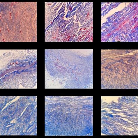 Figureii Fig（g、h、i）the Distribution Of Muscle And Fibrous Tissue In