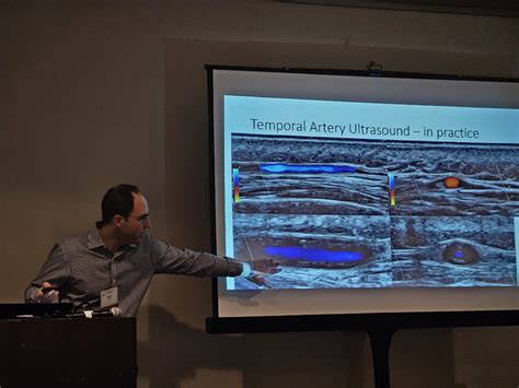 American College Of Rheumatologyeular Classification Criteria For Gca