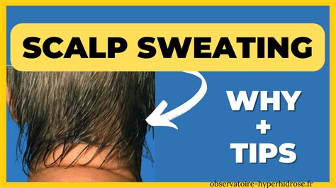 Excessive Scalp Sweating Why And How To Stop