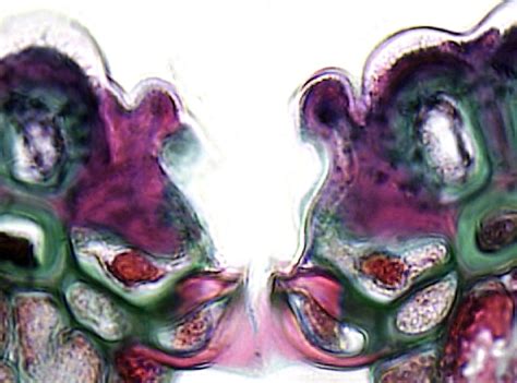 Gymnosperm Leaves Stomatal Pits In Single Needled Pinus Plant