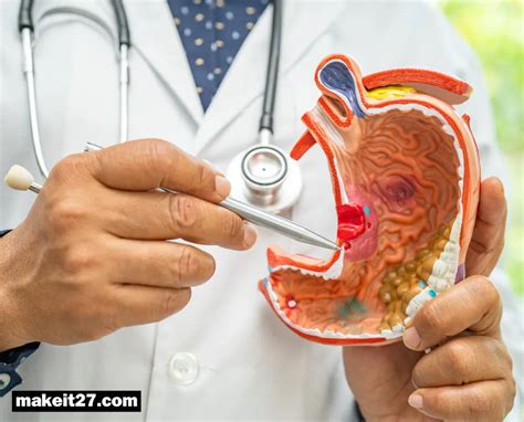 의학용어 Gist Gi Egc Makeit27