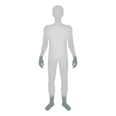 Welche Faktoren Können Eine Cidp Auslösen Erfahre Mehr über Genetische