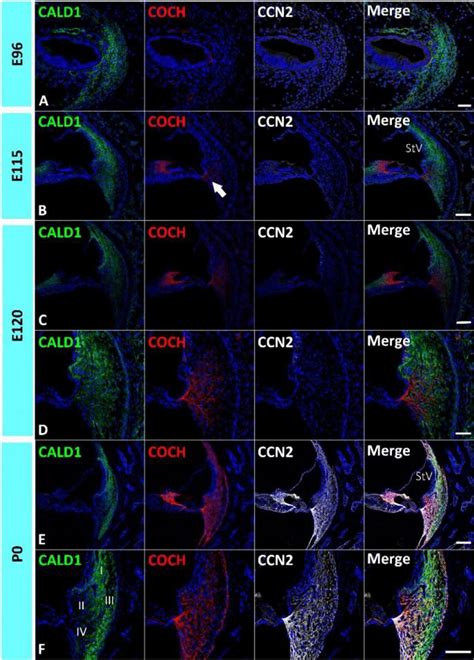 expression of cald1 coch and ccn2 a expression of cald1 coch and download scientific