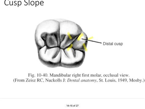 Sample Drawings Tooth Morphology 42 Off