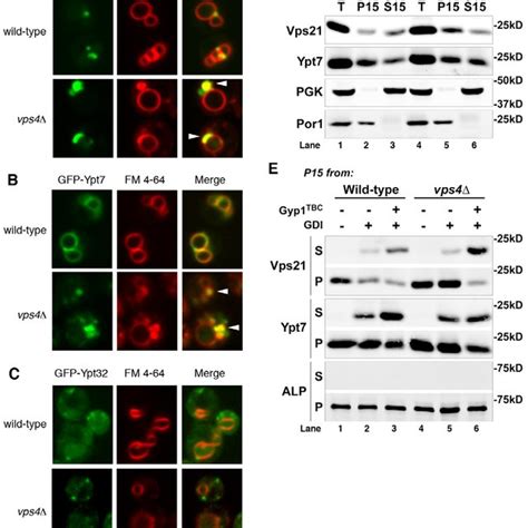 Vps21 Is Concentrated At Class E Compartments In Its Active Gtp Bound Download Scientific