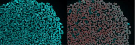 Instance Segmentation Of Cells And Nuclei Made Simple Using Deep